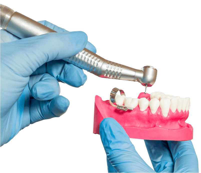 Benefits of teeth implantation - Dr Sanjog Chandak
